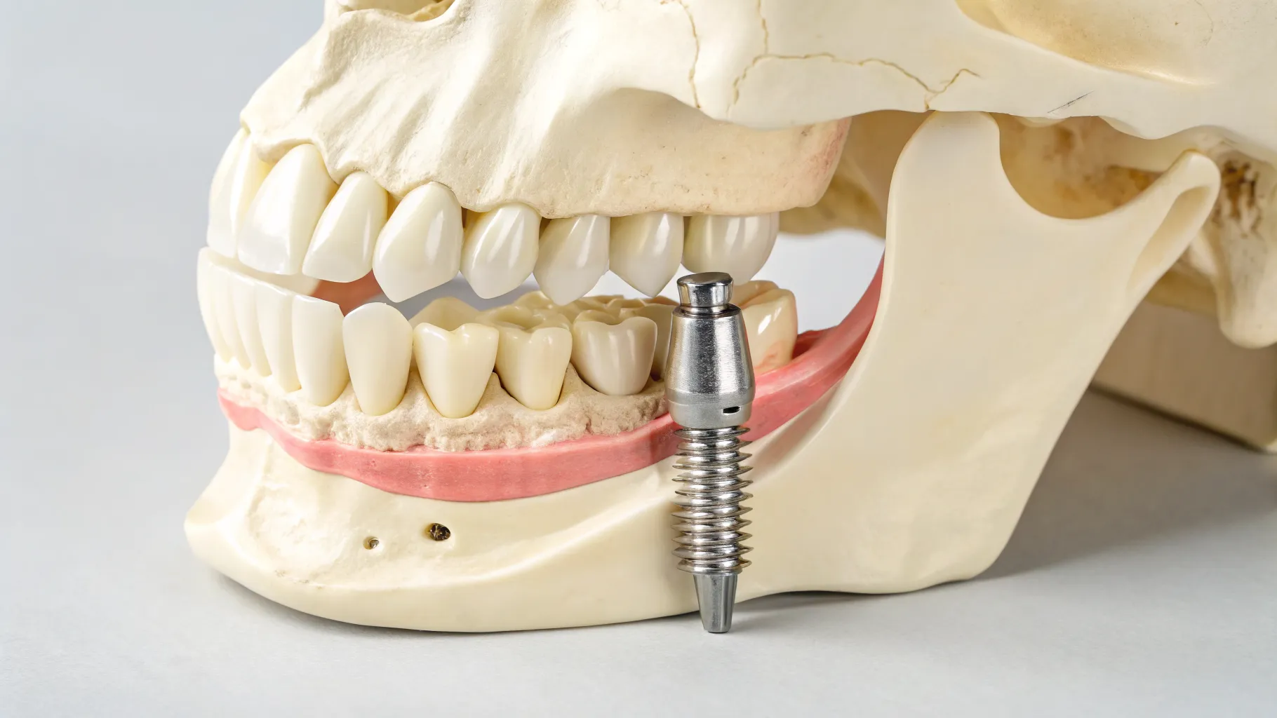 A Complete Guide to Tooth Replacement Options